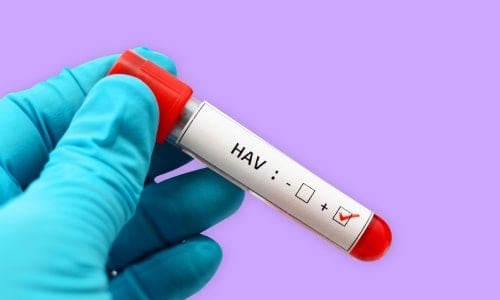 HAVS – One Education