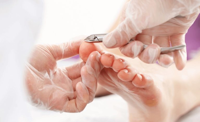 Everything You Need to Know About Podiatry and Chiropody